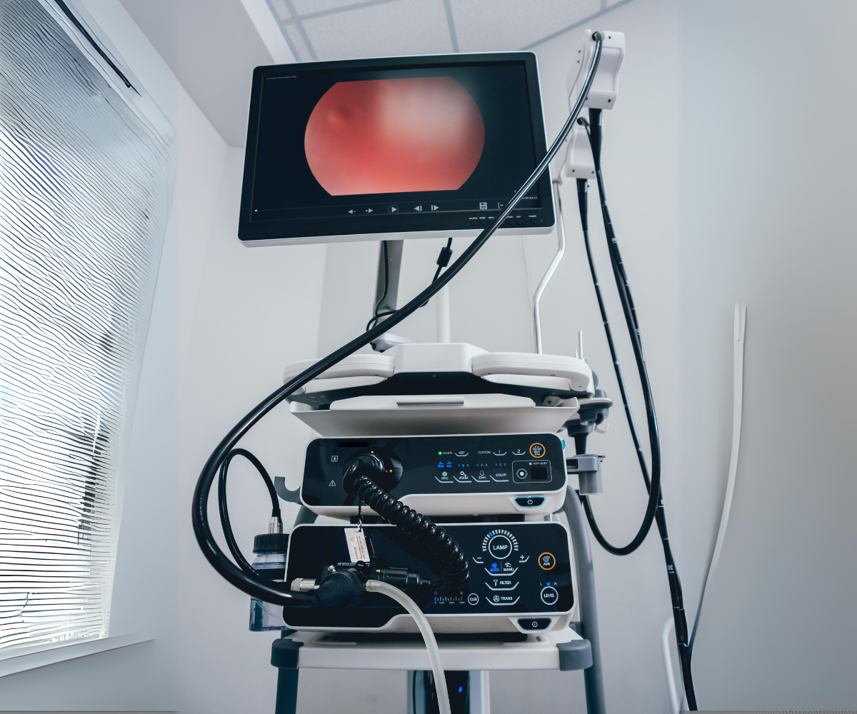 Endoscopy - WinLanka Hospitals